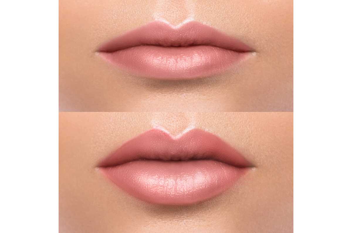 labios-carnosos-sin-metodos-invasivos-1